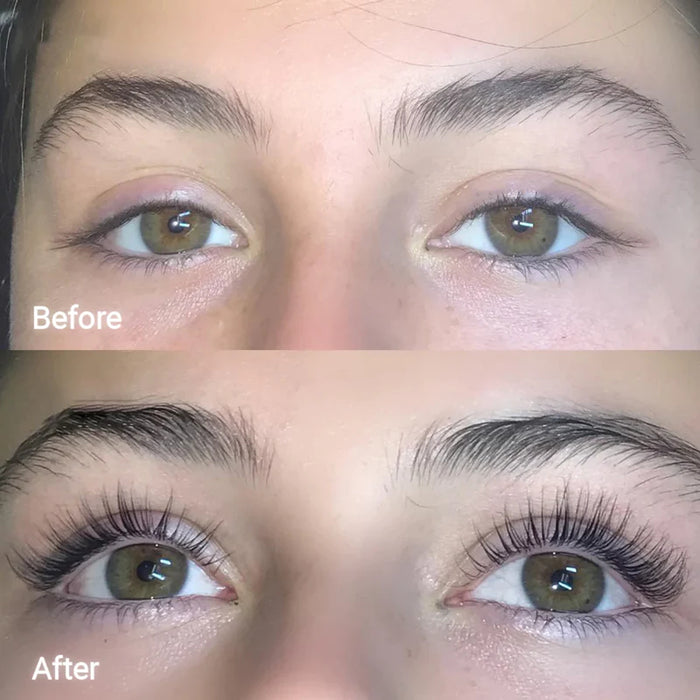 ForLash | Eyelash Growth Enhancing Serum by ForChics
